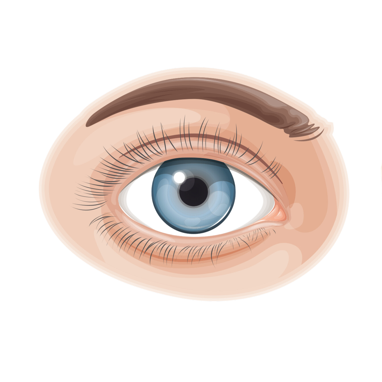 Cataracts – IOL Expert