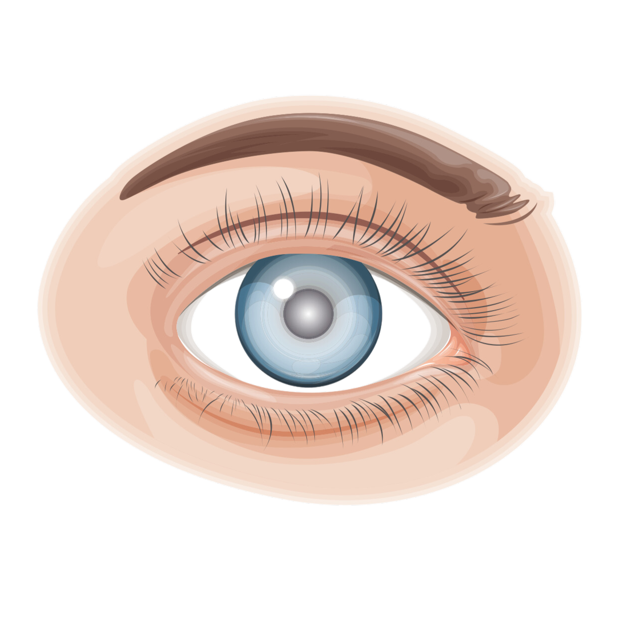 Cataracts – IOL Expert